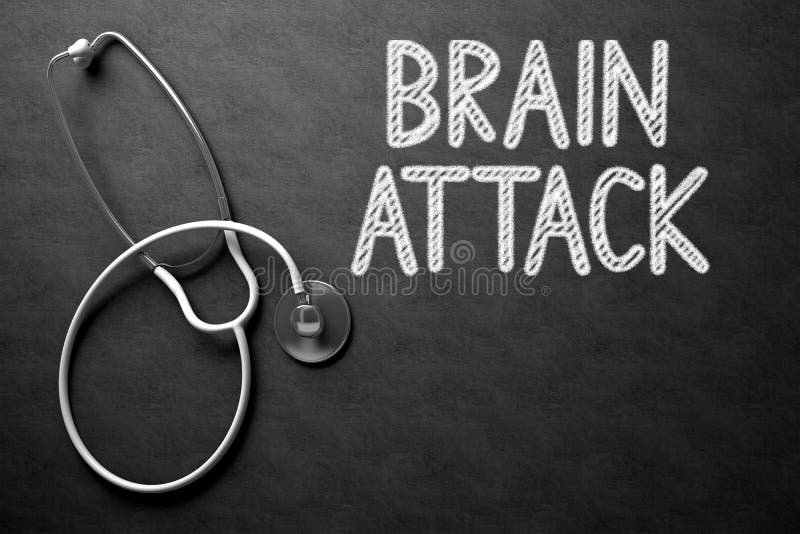 Brain Attack Op Bord 3D Illustratie Stock Illustratie - Illustration of ...