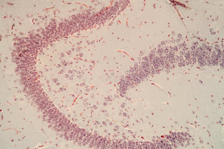 Brain cells tissue stock image. Image of microscopy - 196729893