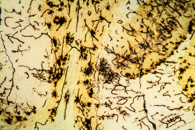 Brain cells tissue stock photo. Image of cells, magnifying - 196730026