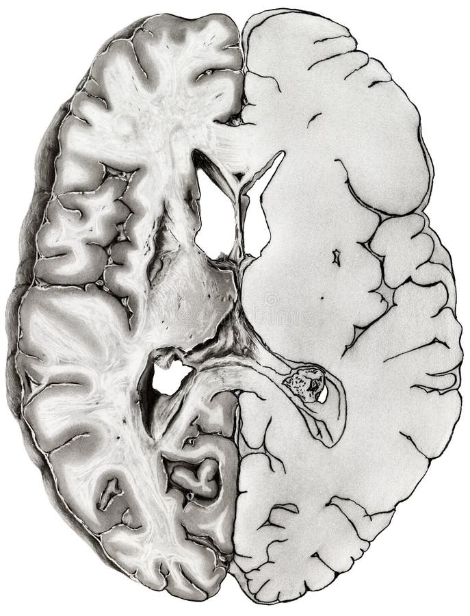 Brain - Cross Section stock illustration. Illustration of cortex - 82091561