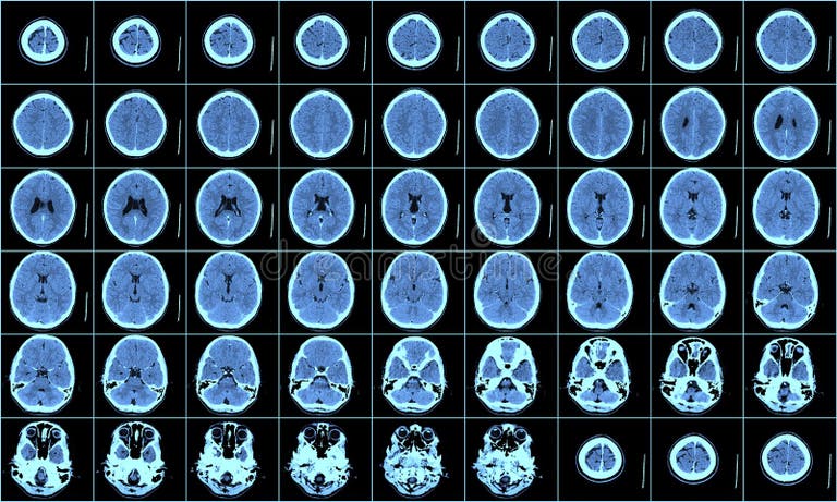 142,538 Scan Fille Stock Photos - Free & Royalty-Free Stock Photos from ...