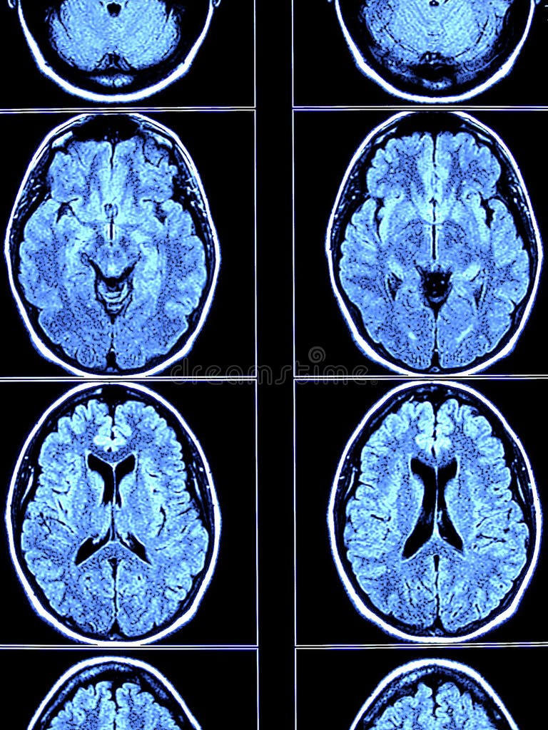 142,538 Scan Fille Stock Photos - Free & Royalty-Free Stock Photos from ...