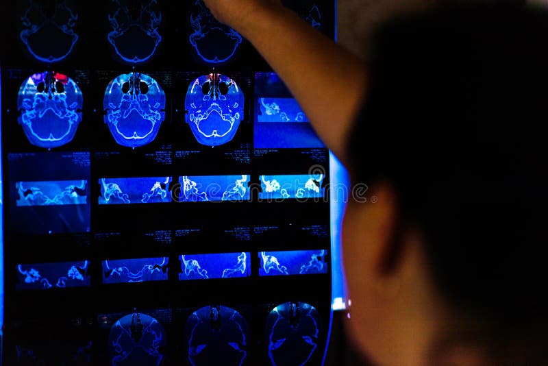 Brain CT Scan X-ray Film Image Brain Stock Photo - Image of medical ...