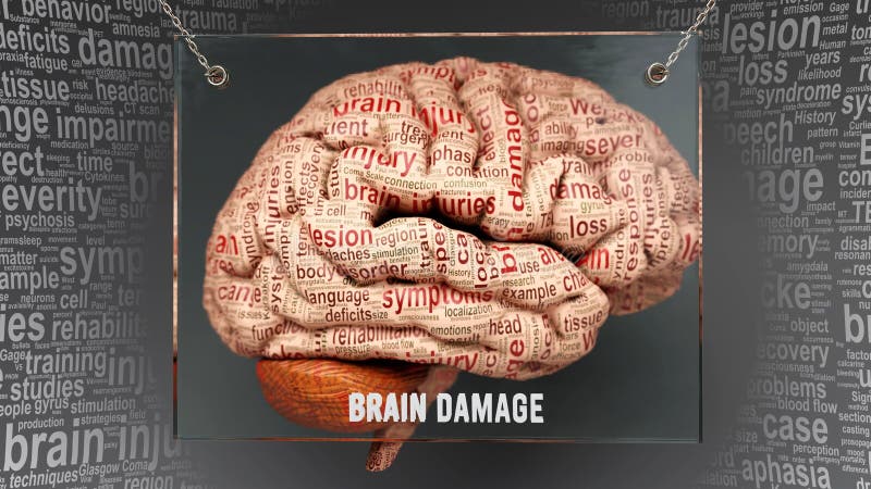 Brain Damage in Human Brain Stock Illustration - Illustration of human ...