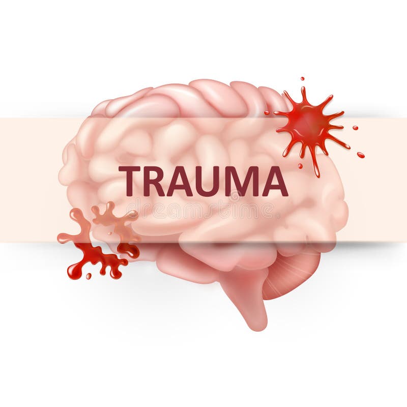 Brain Trauma stock illustration. Illustration of depression - 38214408
