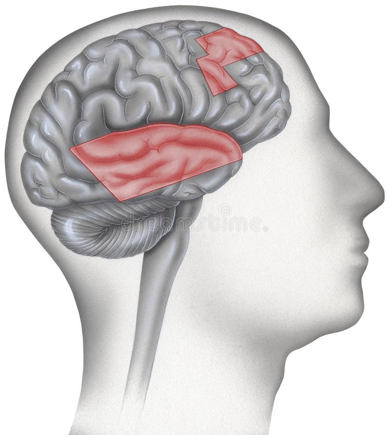 Brain - Dyslexia, Areas Involved Highlighted Stock Illustration ...