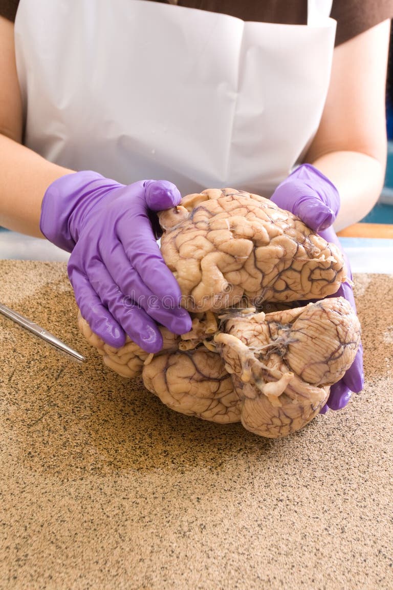 Human Brain Disection Stock Photos - Free & Royalty-Free Stock Photos ...