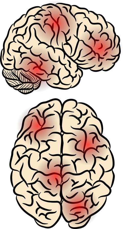 Brain fever stock illustration. Illustration of inspiration - 44606247
