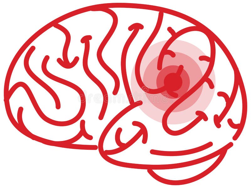The Brain Has a Red Signal on White Background Stock Vector ...