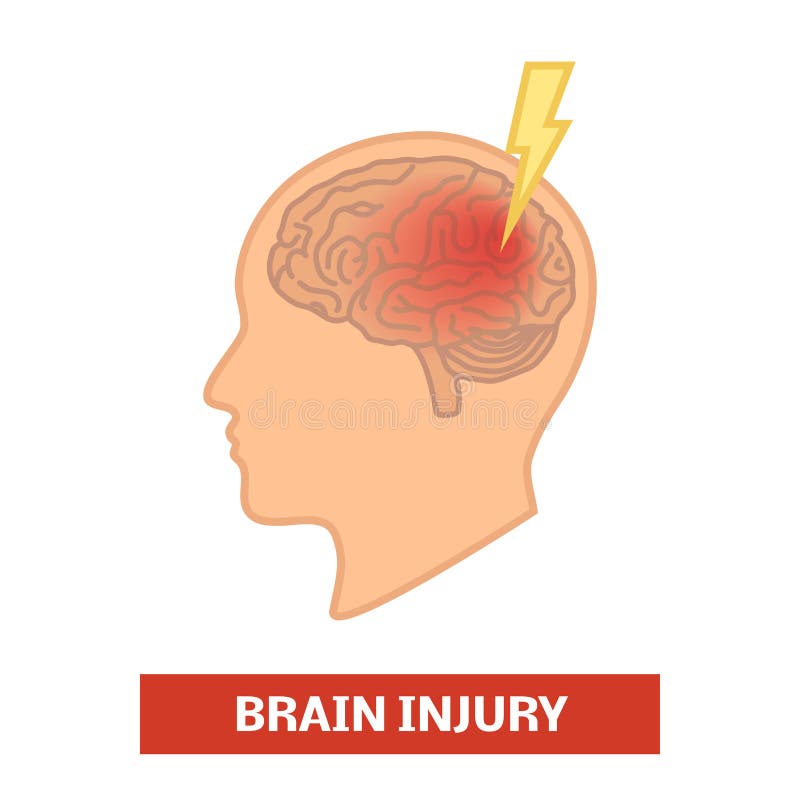 Cartoon Head Injury Stock Illustrations – 1,059 Cartoon Head Injury 333