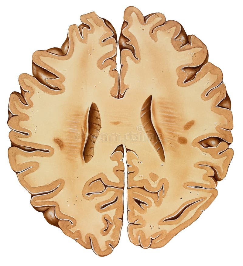 Brain - Lower Region Cross Section Stock Illustration - Illustration of ...