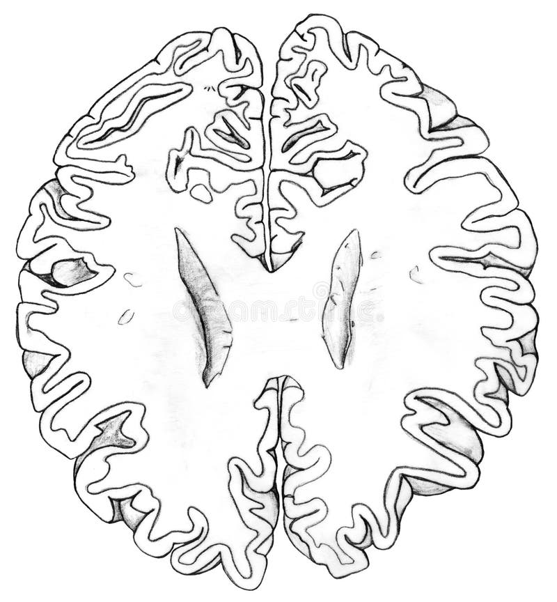Brain Cross Section Stock Illustrations – 442 Brain Cross Section Stock ...