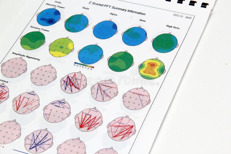 Brain Maps Stock Photos - Free & Royalty-Free Stock Photos from Dreamstime