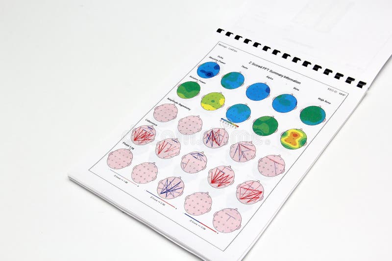 Brain Mapping Done by a Neurologist Doctor with Neuroscience Technique ...