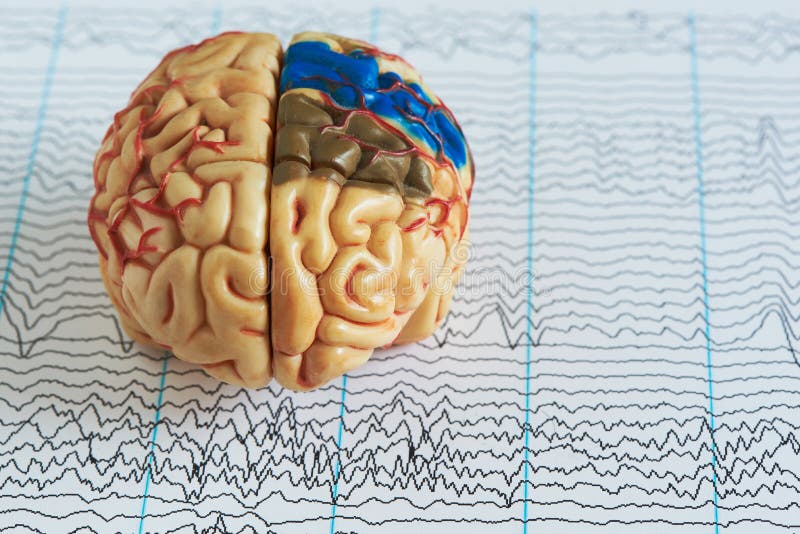 Brain Model on Human Brain Wave Background Stock Image - Image of ...
