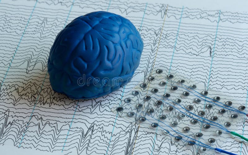 Invasive Eeg Stock Photos - Free & Royalty-Free Stock Photos from ...