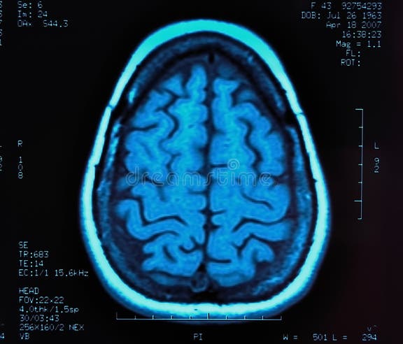 18,169 Mri Image Npg Stock Photos - Free & Royalty-Free Stock Photos ...