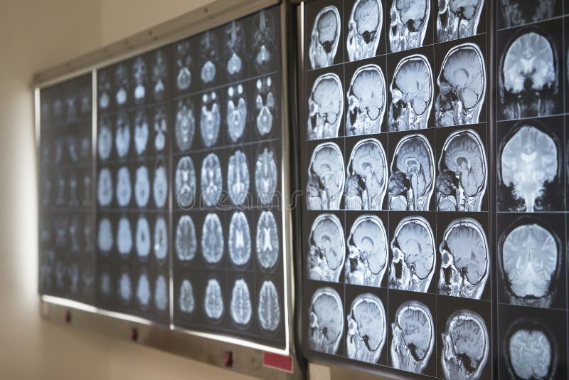 Xray Lightbox Stock Photos - Free & Royalty-Free Stock Photos from ...