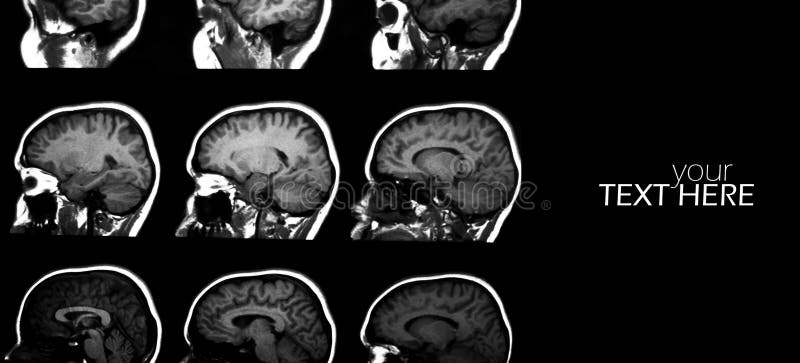 Brain MRI scan stock image. Image of person, copy, anatomy - 164575589