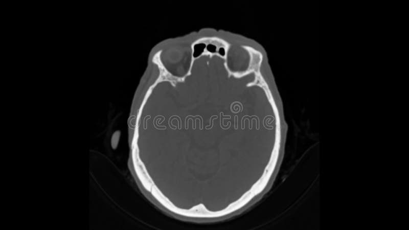 Brain MRI Scan Imaging - Loop Stock Video - Video of brain, seamless ...