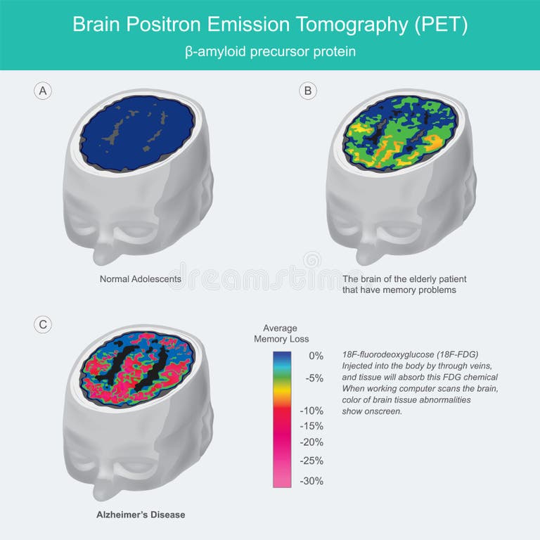 Pet Scans Stock Illustrations – 58 Pet Scans Stock Illustrations ...