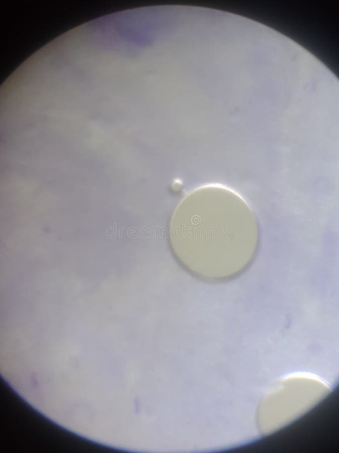 The Brain of a Pig Under the Microscope Stock Image - Image of neurons ...