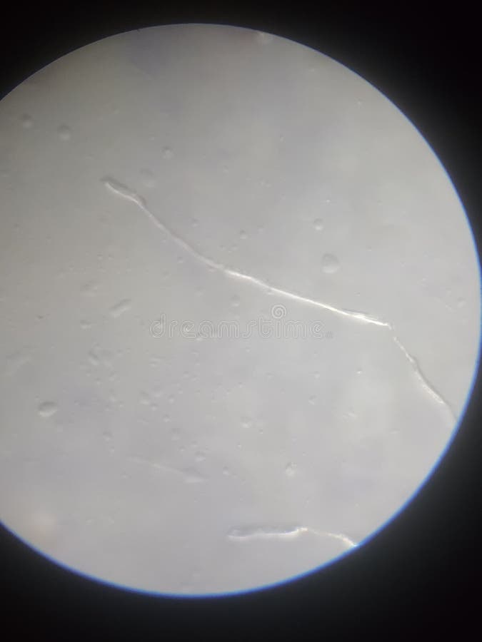 The Brain of a Pig Under the Microscope Stock Image - Image of neurons ...