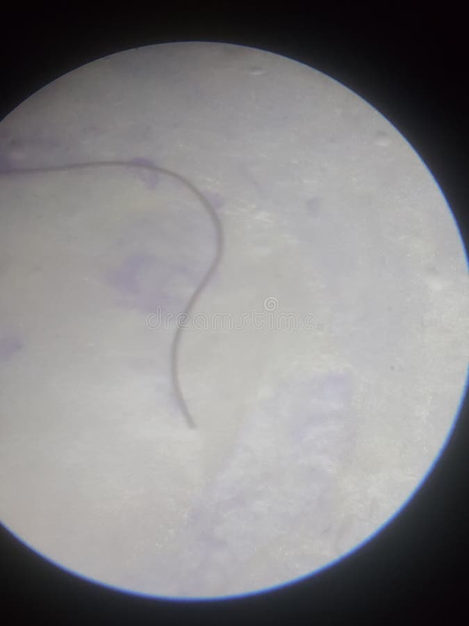 The Brain of a Pig Under the Microscope Stock Photo - Image of ...