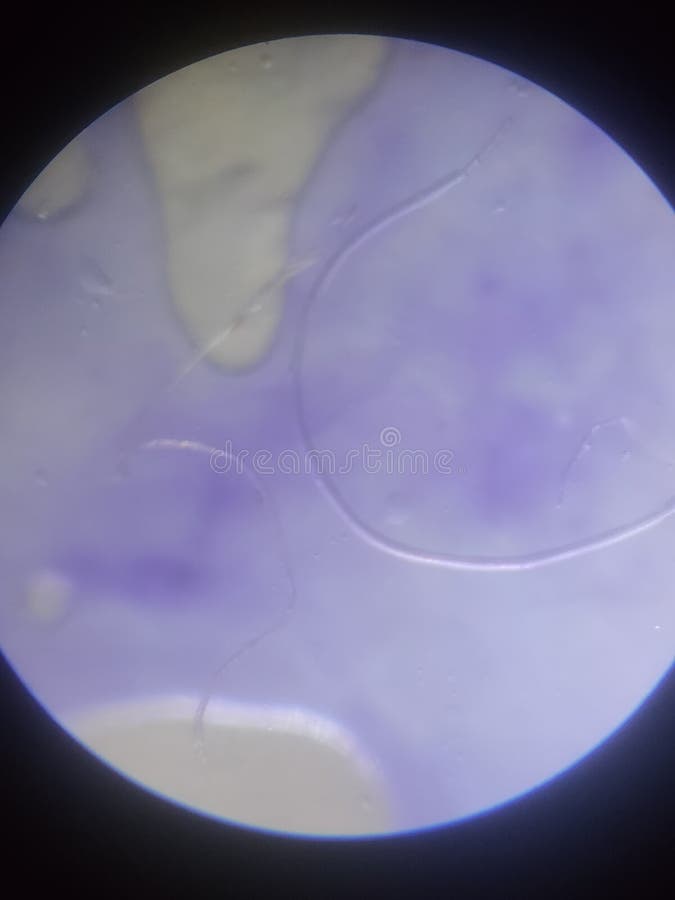 The Brain of a Pig Under the Microscope Stock Photo - Image of meat ...