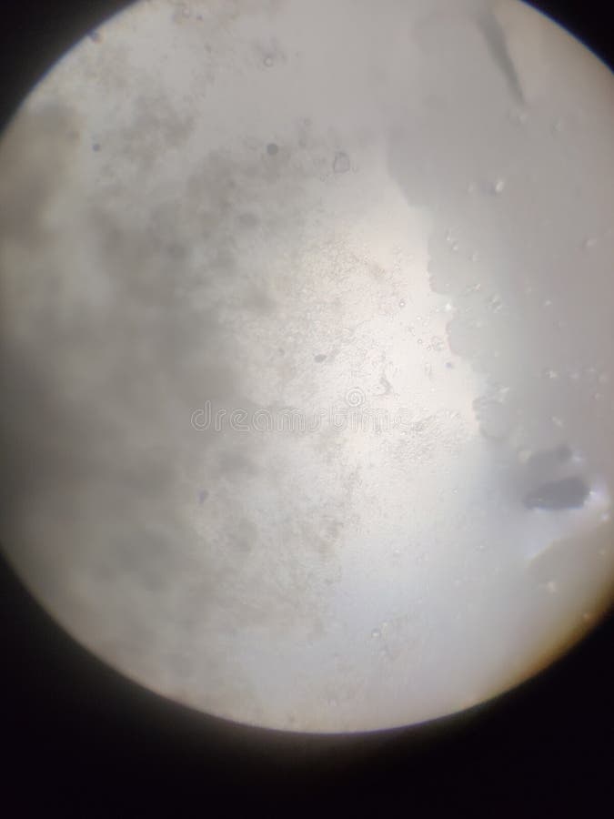 The Brain of a Pig Under the Microscope Stock Photo - Image of brain ...