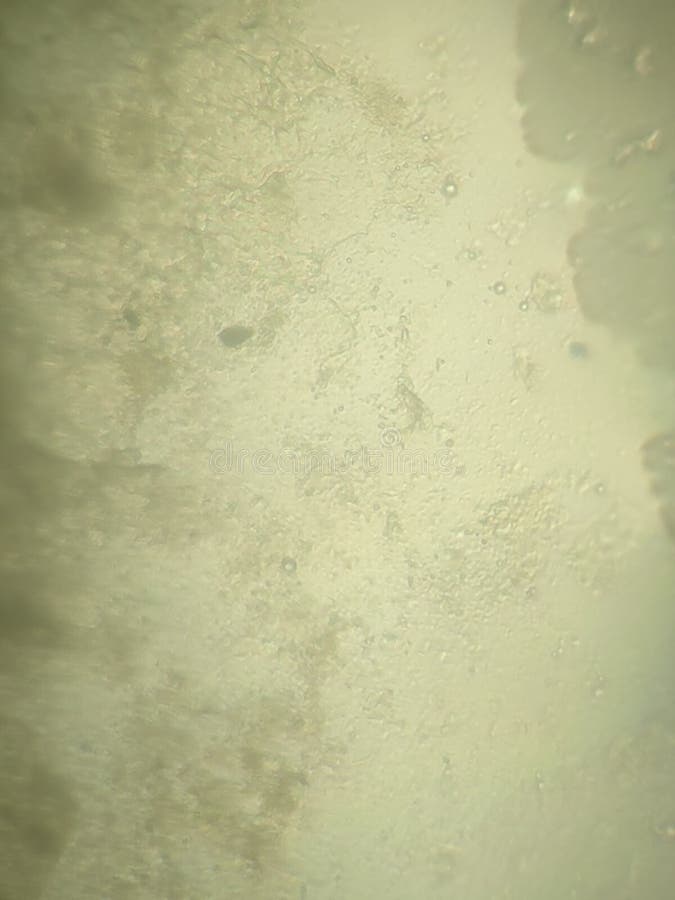 The Brain of a Pig Under the Microscope Stock Image - Image of brain ...