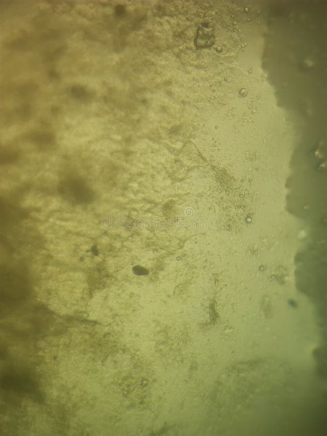 The Brain of a Pig Under the Microscope Stock Photo - Image of ...