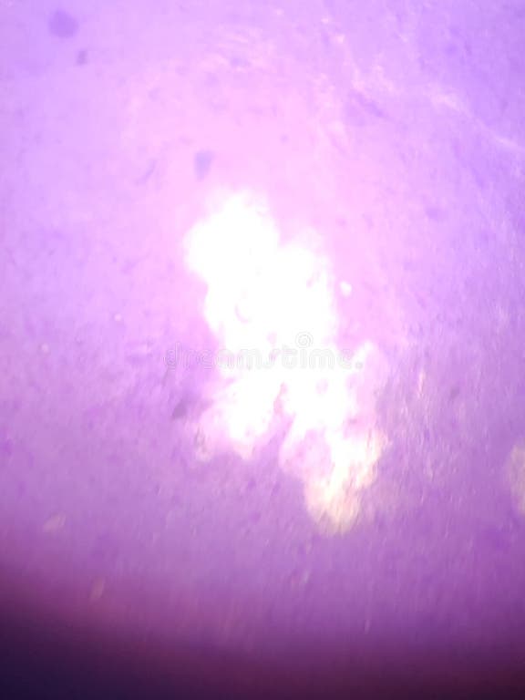 The Brain of a Pig Under the Microscope Stock Photo - Image of biology ...