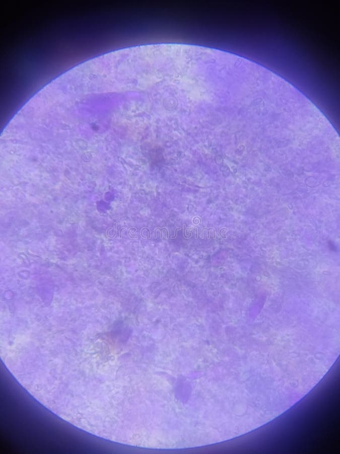 The Brain of a Pig Under the Microscope Stock Photo - Image of pork ...