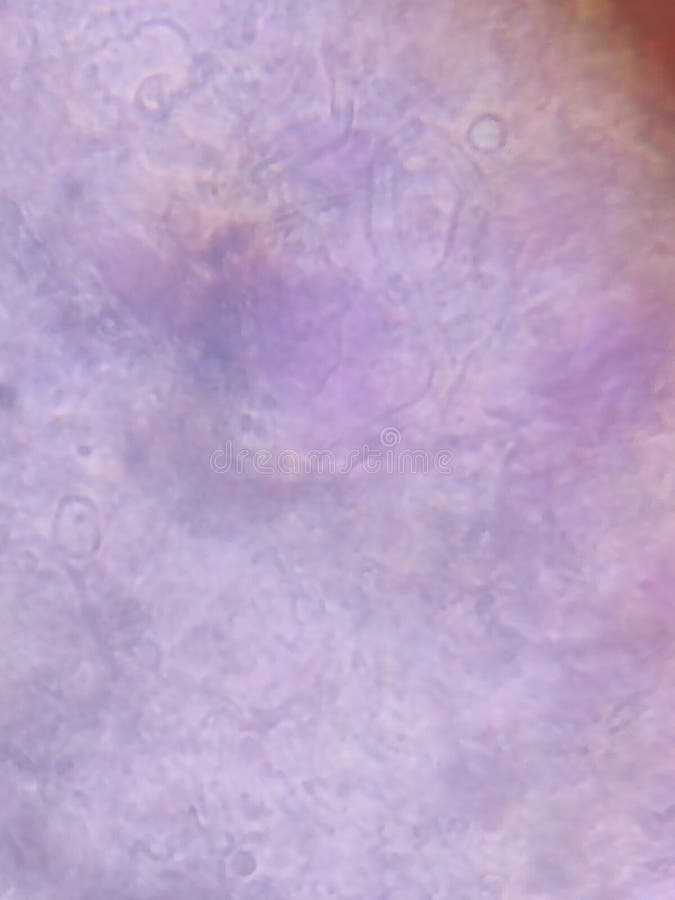 The Brain of a Pig Under the Microscope Stock Photo - Image of ...