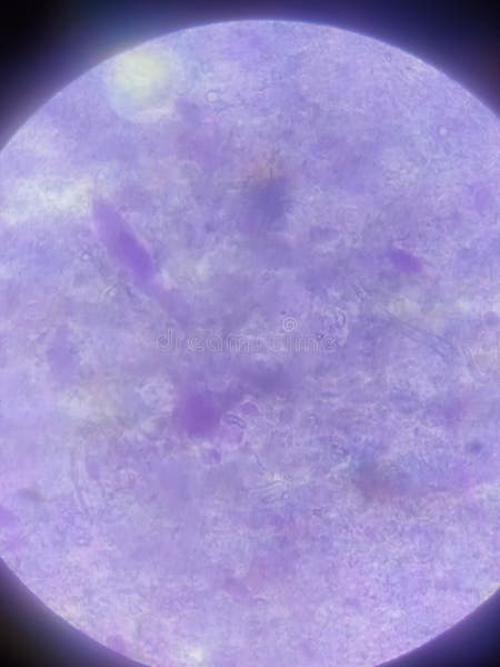 The Brain of a Pig Under the Microscope Stock Image - Image of neurons ...