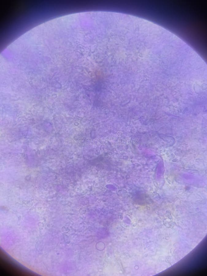 The Brain of a Pig Under the Microscope Stock Photo - Image of meat ...