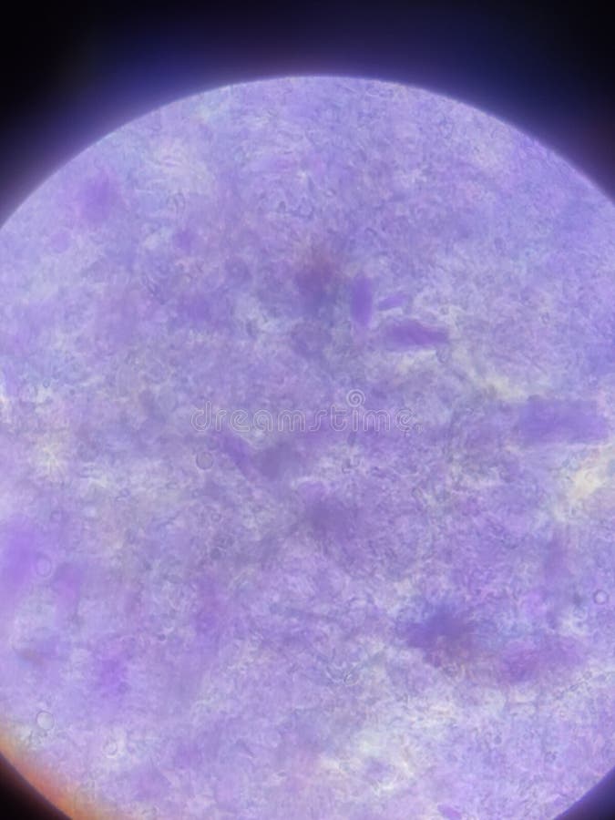 The Brain of a Pig Under the Microscope Stock Image - Image of ...