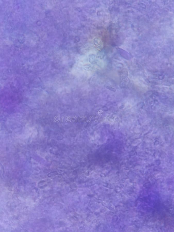 The Brain of a Pig Under the Microscope Stock Image - Image of neurons ...