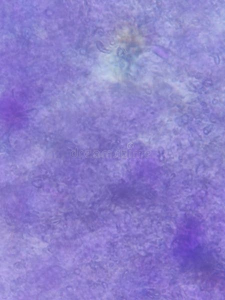 The Brain of a Pig Under the Microscope Stock Photo - Image of pork ...