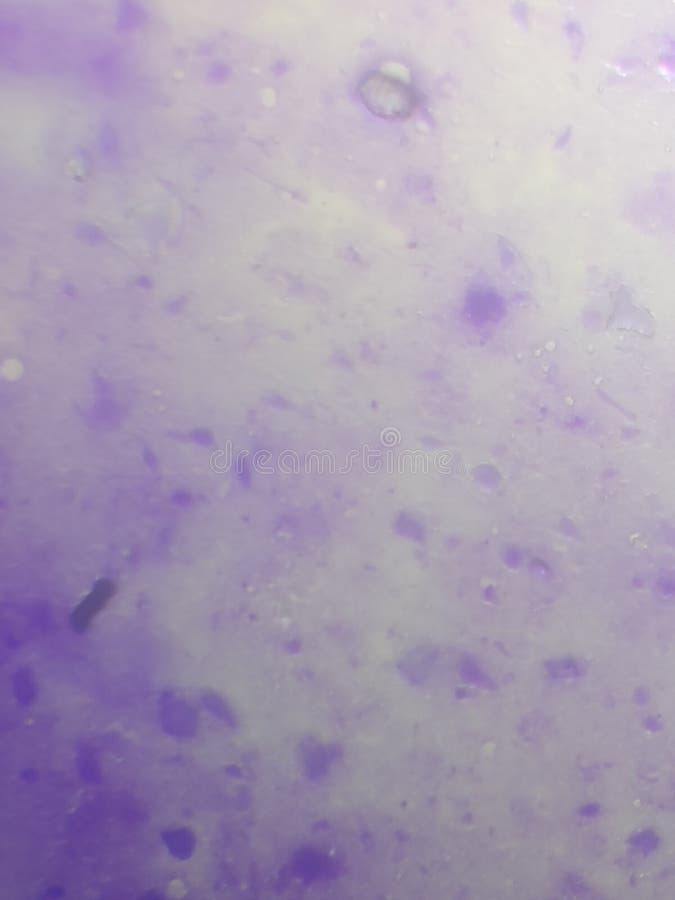 The Brain of a Pig Under the Microscope Stock Photo - Image of ...