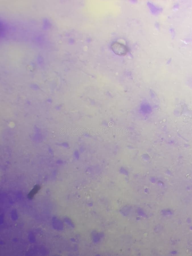 The Brain of a Pig Under the Microscope Stock Photo - Image of biology ...