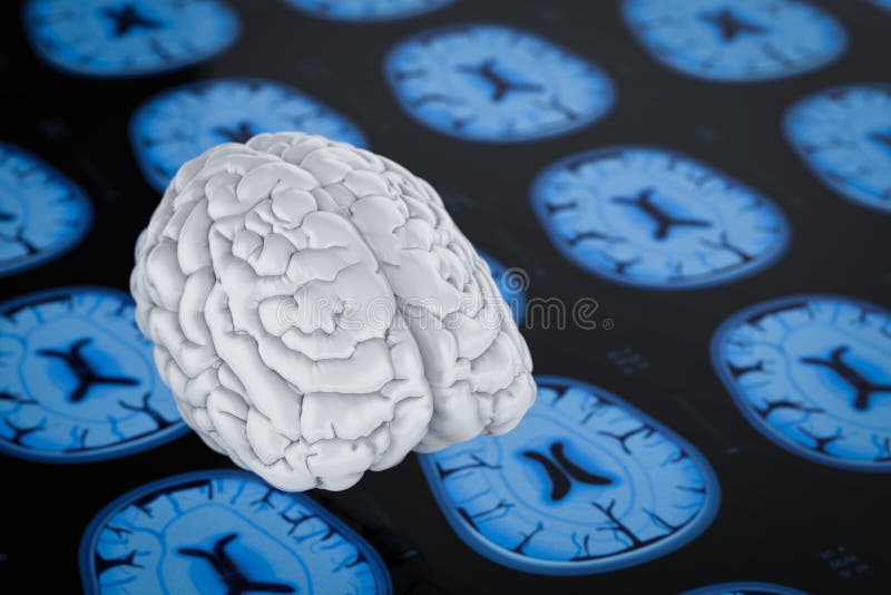 Brain Imaging Background Stock Illustrations – 914 Brain Imaging ...