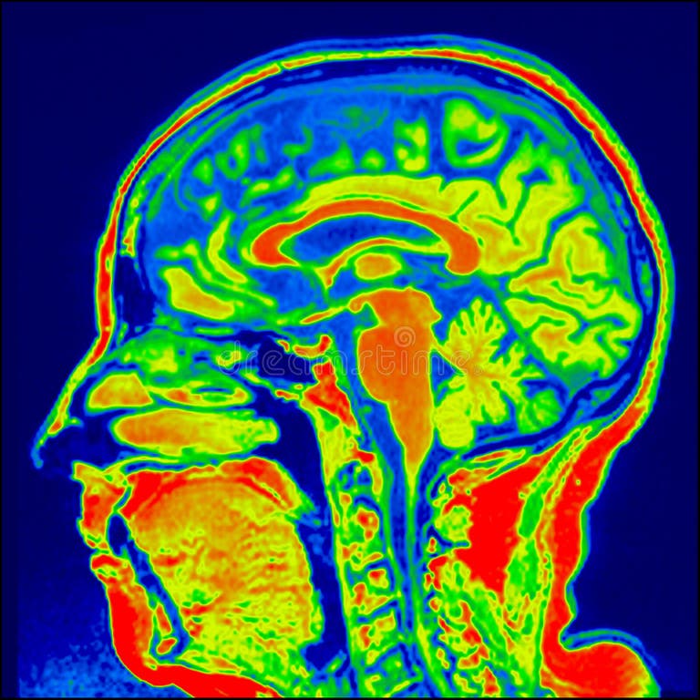 Anatomia Radiografia Perro Stock Photos - Free & Royalty-Free Stock ...