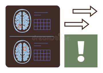 Brain Scan Analysis with Arrows and Alert Symbol Representing Data Interpretation and Decision ...