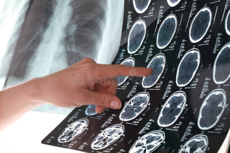 Brain stock photo. Image of scan, brain, illuminated - 62795842