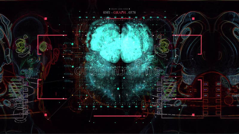 Brain Mri Scan Showing Tumor Growing in Head, Medical Imaging for ...