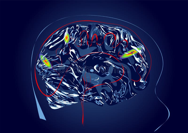 Brain Scan Vector Illustration Stock Vector - Illustration of neurology ...