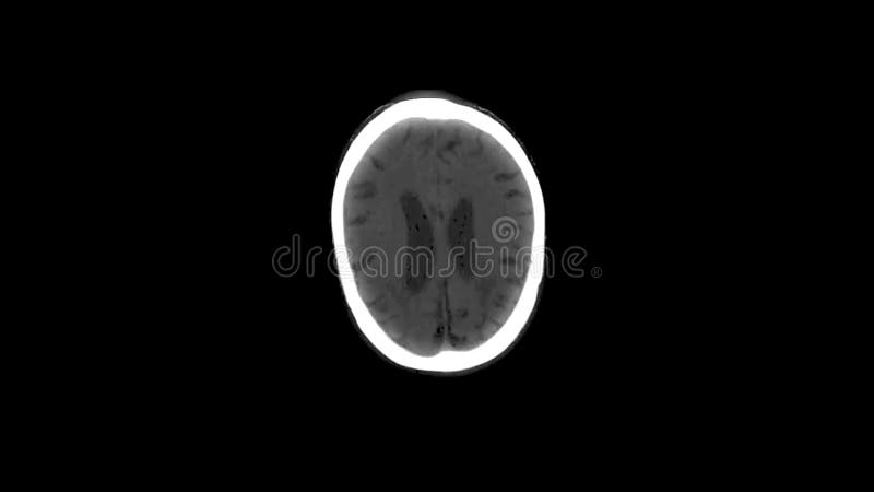Brain Scan Visualization Animation. Diagnosis Data on Laboratory ...