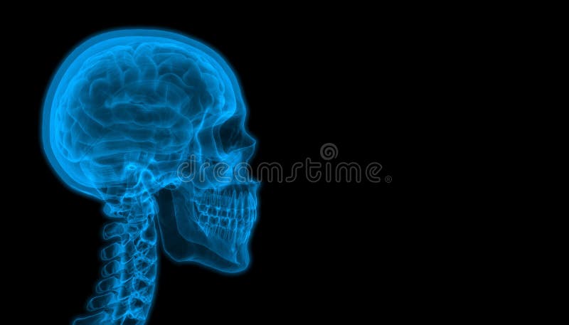 Brain Scan Xray Redux Blue - 2018 Stock de ilustración - Ilustración de ...